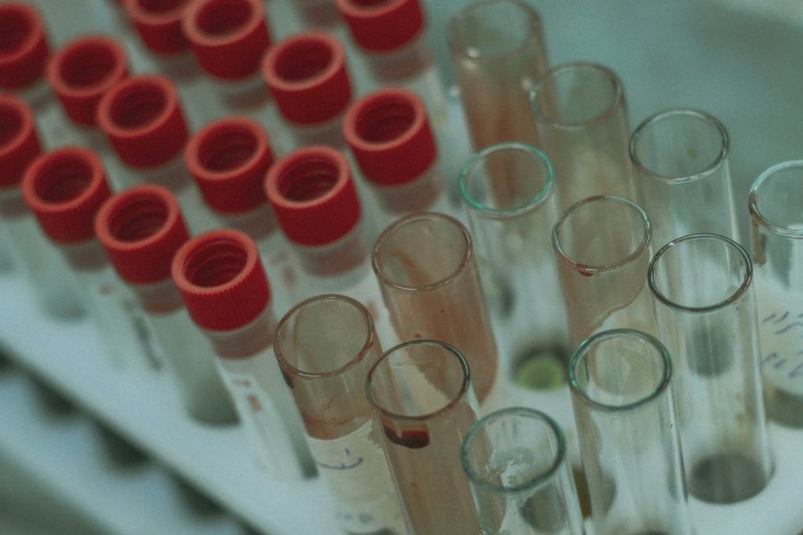 Erasmus MC zet labrobot in tegen druk op diagnostiek